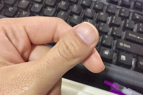 大拇指短宽大拇指甲短宽大山谷图库